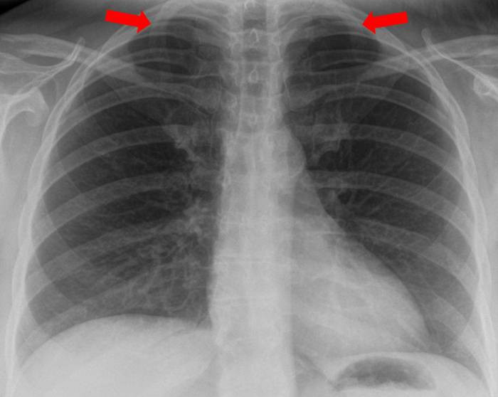 Kardiologie - Röntgen-Thorax, Thorax-CT, Kardio-CT, Kardio-MR