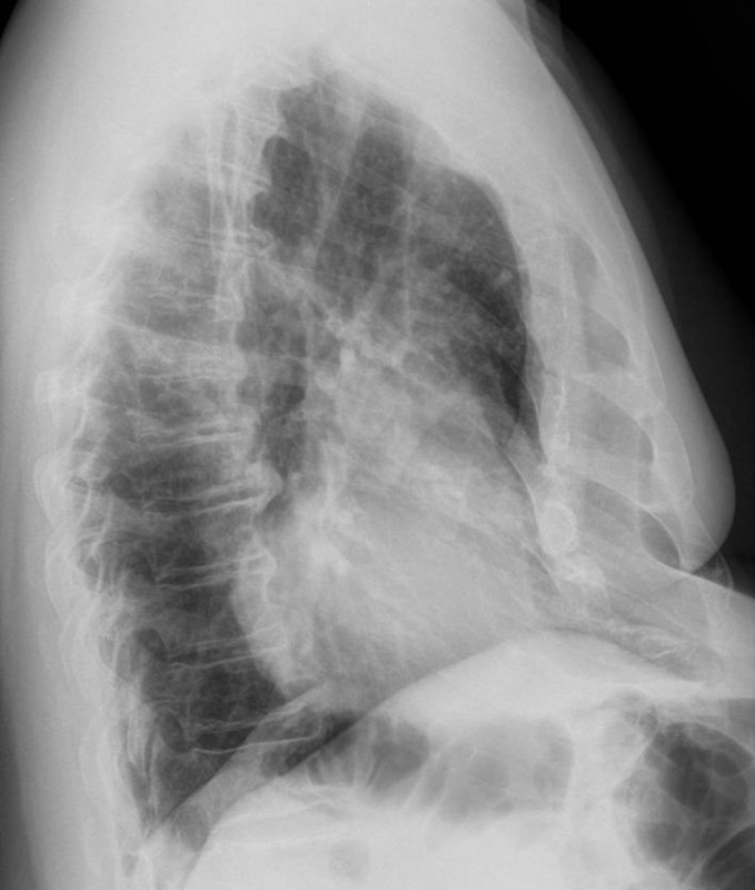 Kardiologie - Röntgen-Thorax, Thorax-CT, Kardio-CT, Kardio-MR